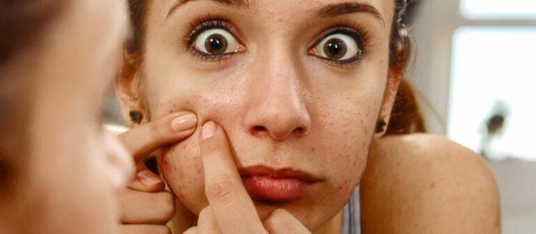 5 Effects Of Stress On The Skin (& How To Deal With It)