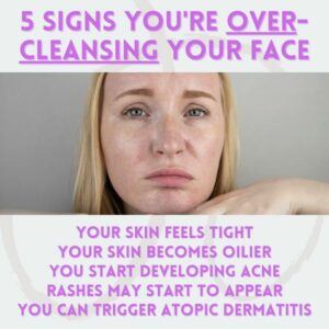 5 Signs You're Over-Cleansing Your Face (& How To Fix It)
