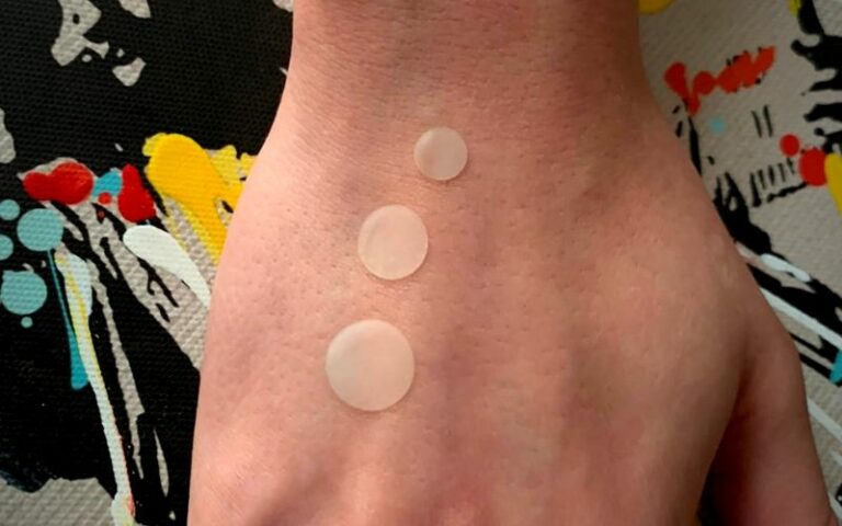 Do Acne Patches Help With Acne? (An Esthetician Explains)