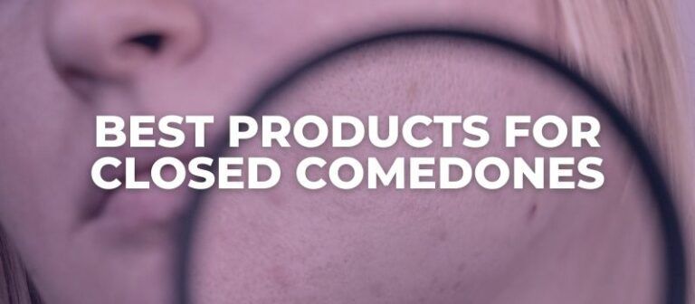 5 Best Products To Get Rid of Closed Comedones
